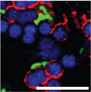 Probe expands understanding of oral cavity homeostasis - MIT Department ...